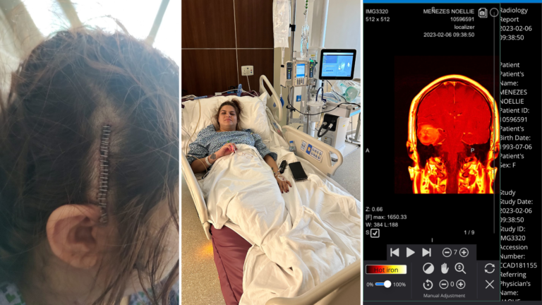 "Five pieces of advice I would give to someone ahead of brain surgery ...