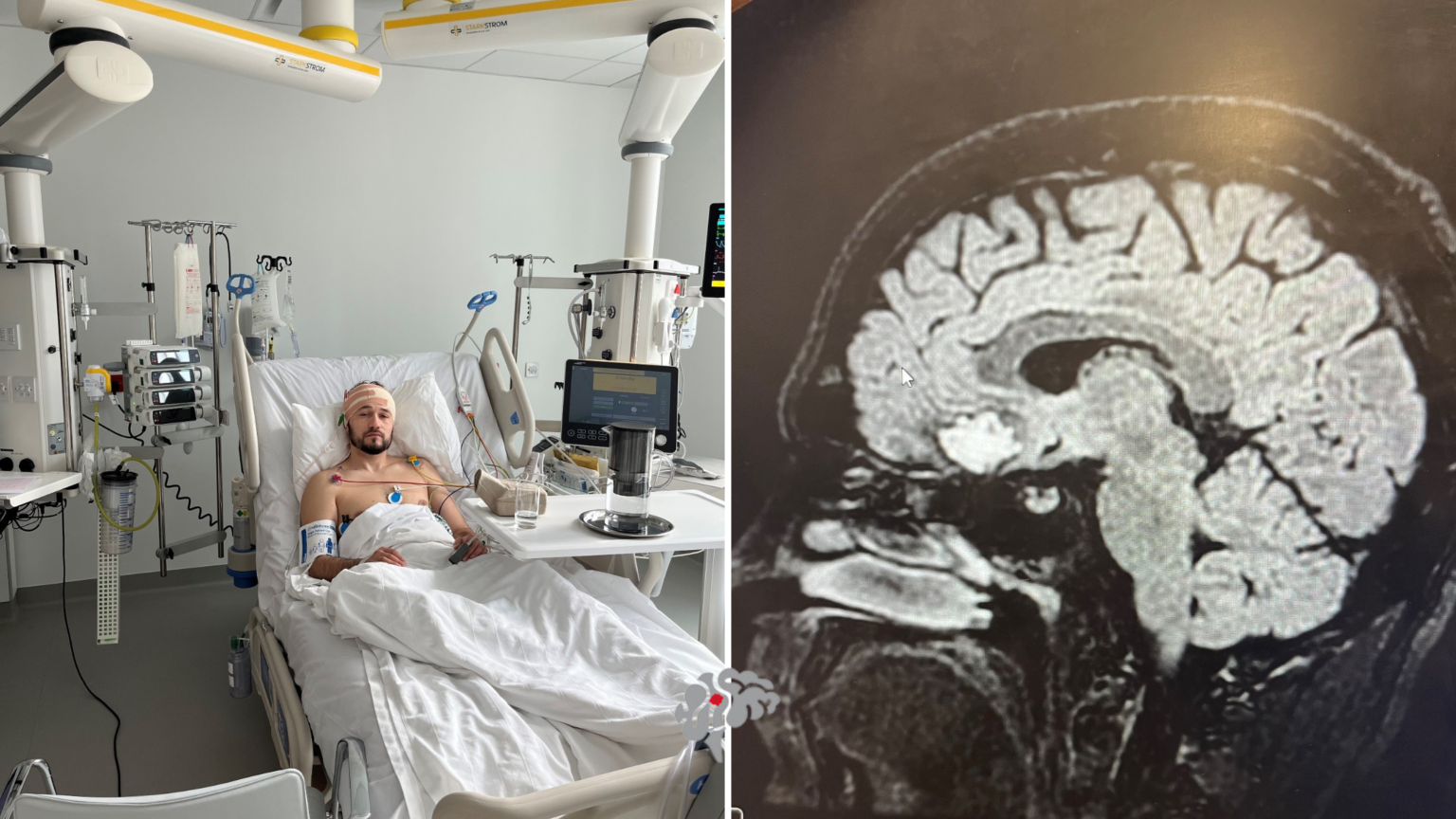 "The thought of having brain surgery was really scary especially as I ...