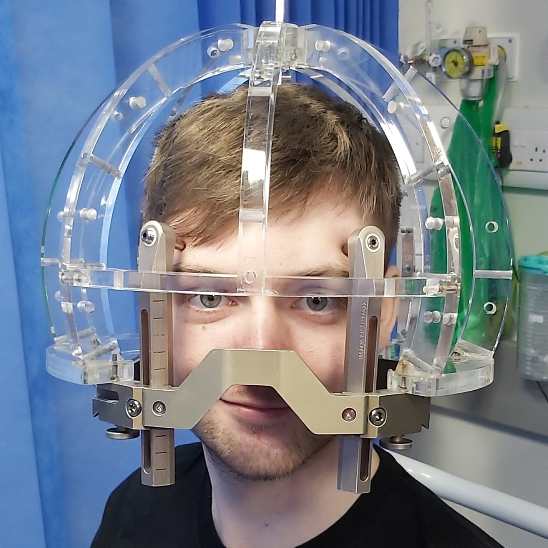 Stereotactic Radiosurgery - Cavernoma Alliance UK (CAUK)